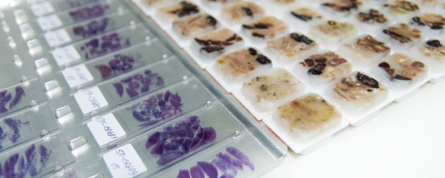 Les accessoires indispensables pour votre microscope