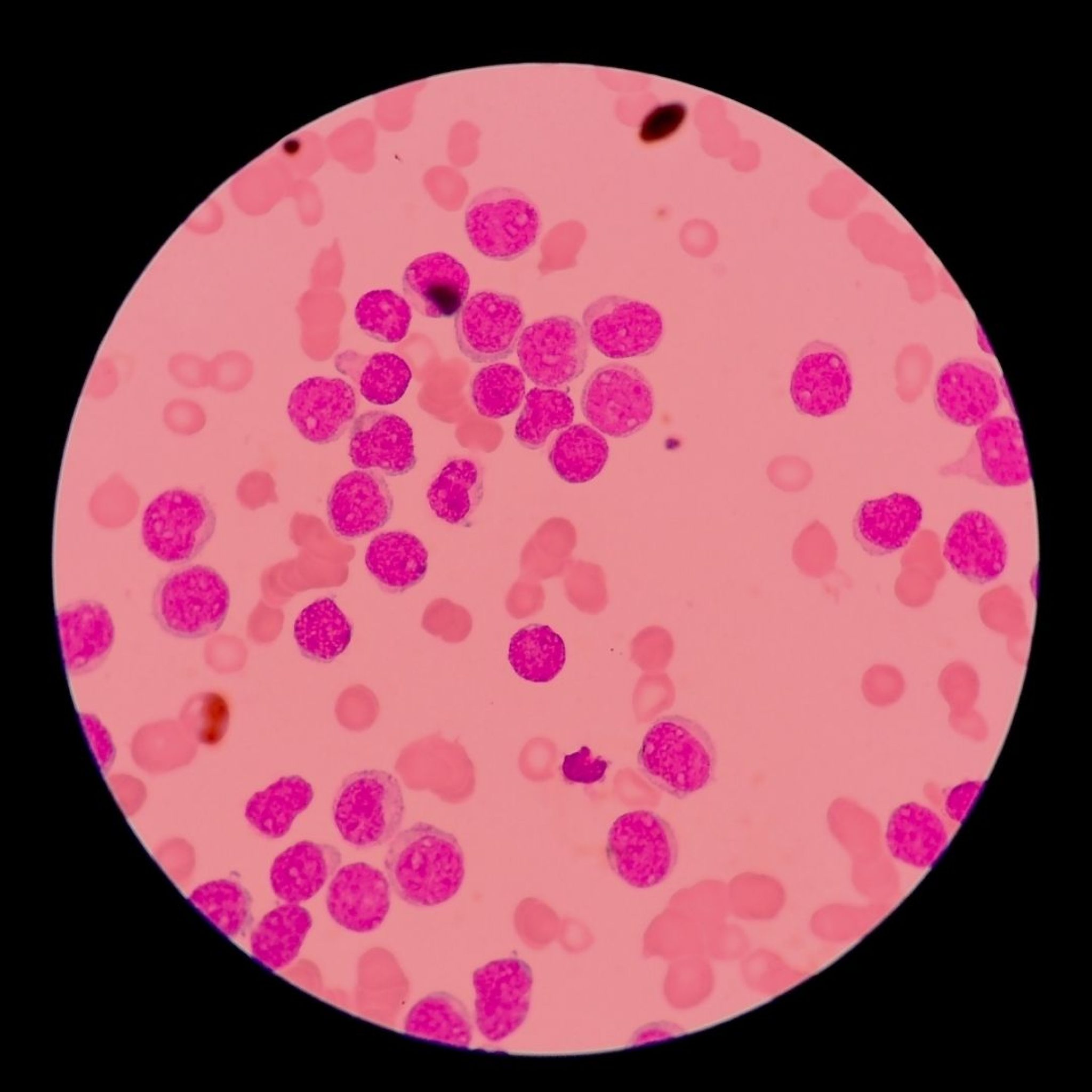 Comment observer une goutte de sang au microscope ? - Meilleurs Microscopes