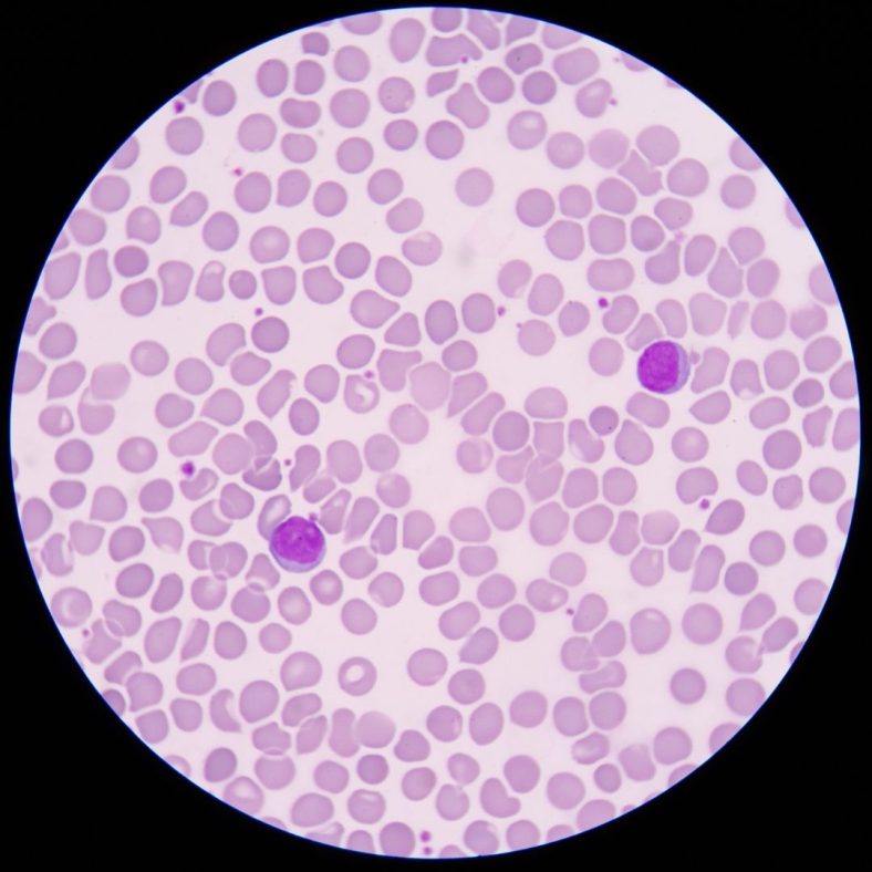 Comment observer une goutte de sang au microscope ? - Meilleurs Microscopes