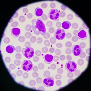 Comment observer une goutte de sang au microscope ? - Meilleurs Microscopes