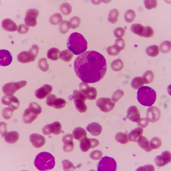 Comment observer une goutte de sang au microscope ? - Meilleurs Microscopes