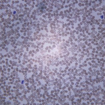 Comment observer une goutte de sang au microscope ? - Meilleurs Microscopes