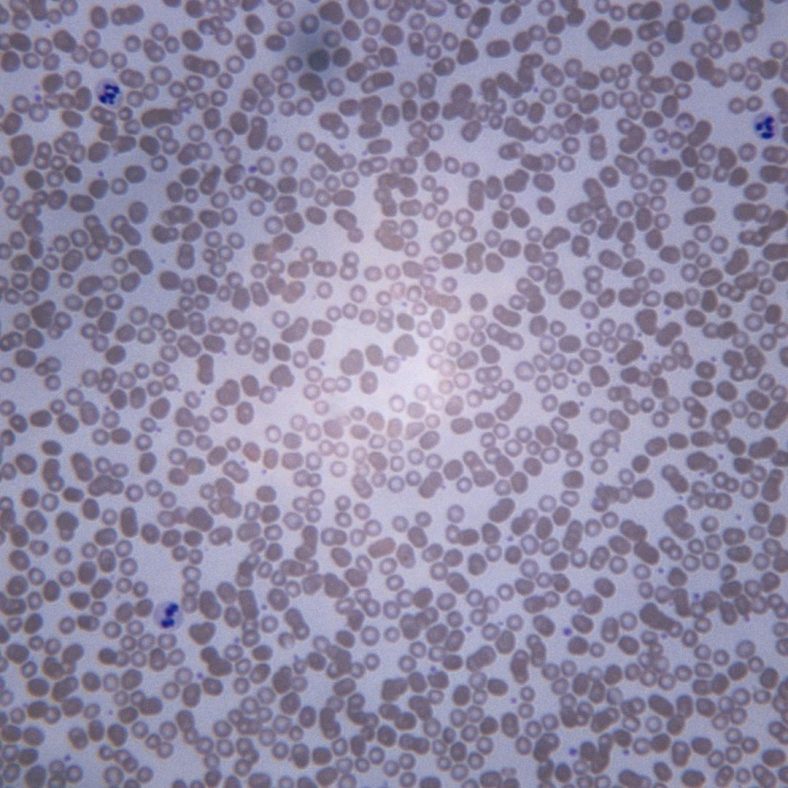 Comment observer une goutte de sang au microscope ? - Meilleurs Microscopes