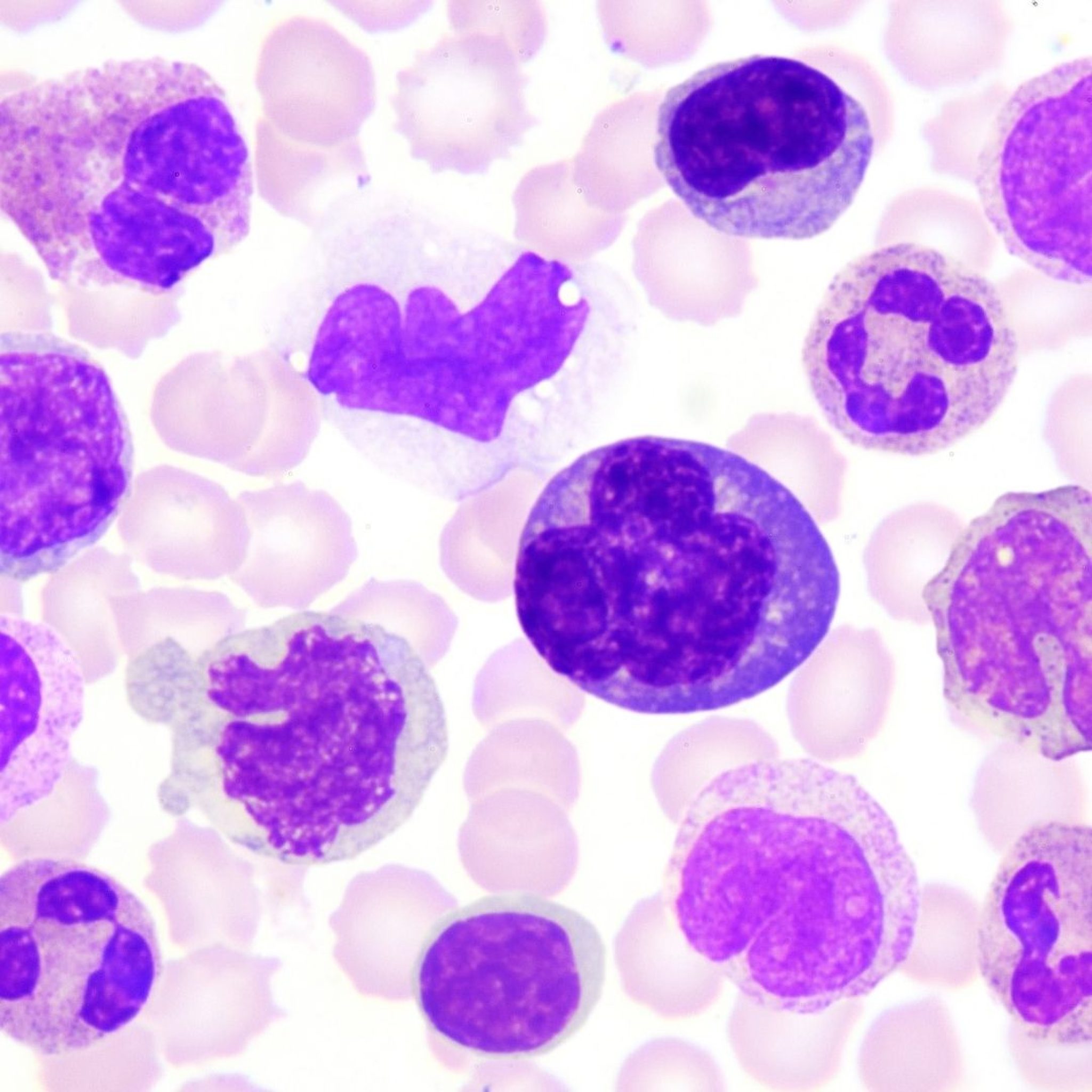 Comment observer une goutte de sang au microscope ? - Meilleurs Microscopes