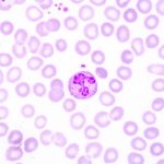 Comment observer une goutte de sang au microscope ? - Meilleurs Microscopes