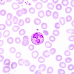 Comment observer une goutte de sang au microscope ? - Meilleurs Microscopes