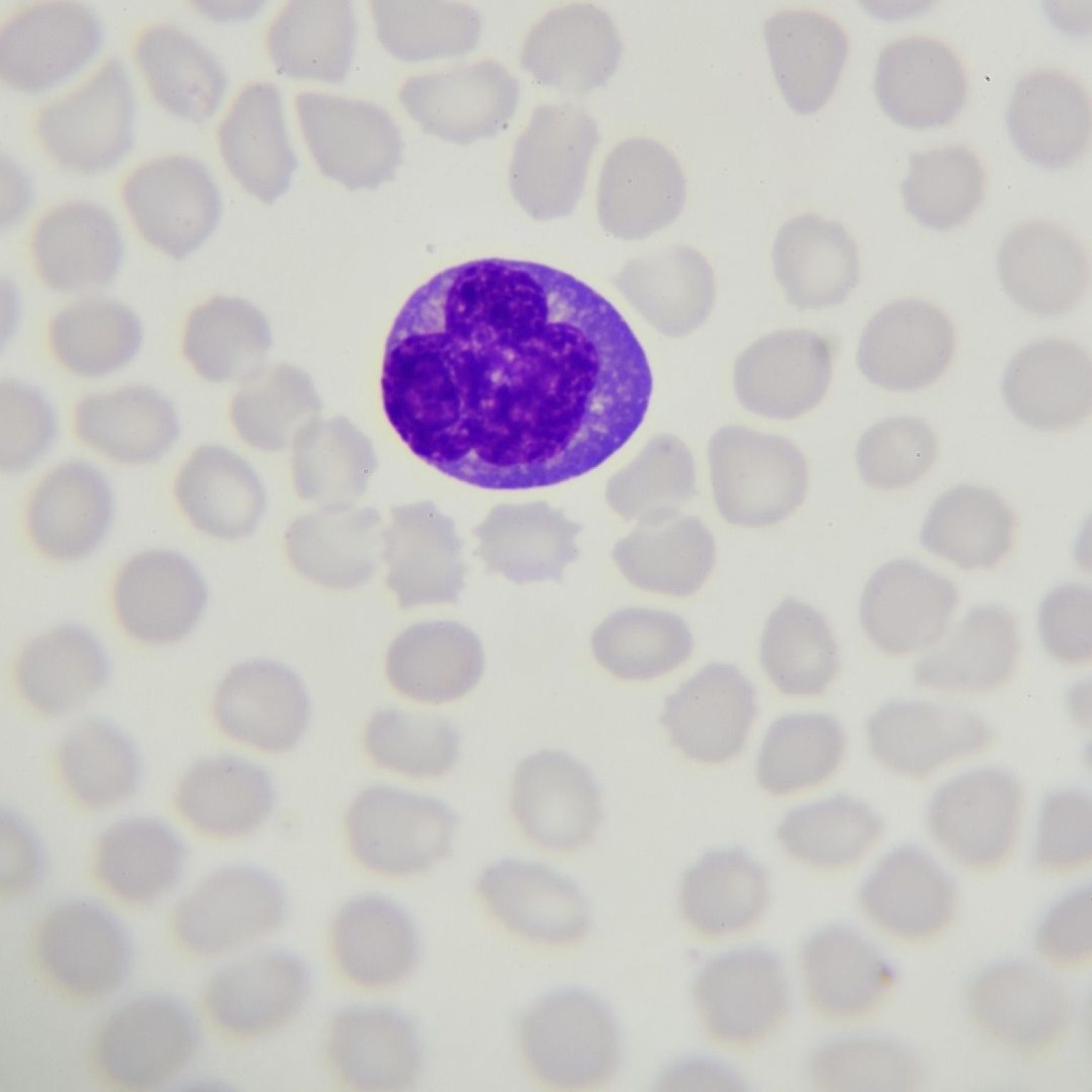 Comment observer une goutte de sang au microscope ? - Meilleurs Microscopes