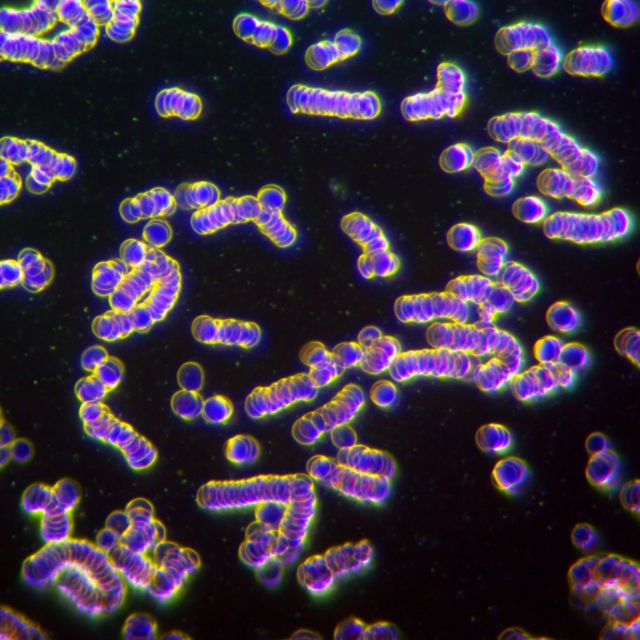 Comment observer une goutte de sang au microscope ? - Meilleurs Microscopes