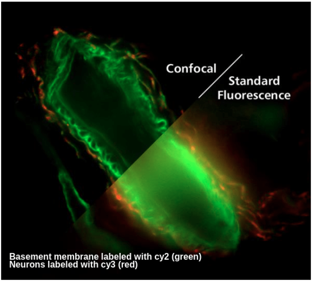 Microscope Confocal - Meilleurs Microscopes