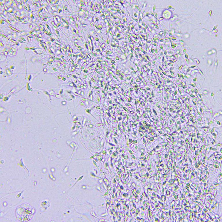 Spermatozoïdes au microscope - Meilleurs Microscopes