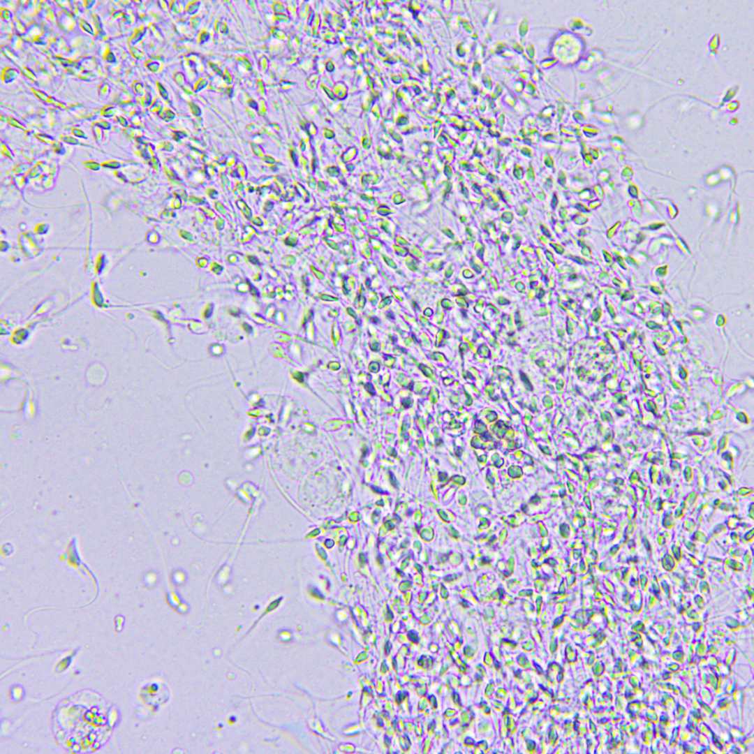 Spermatozoïdes au microscope - Meilleurs Microscopes