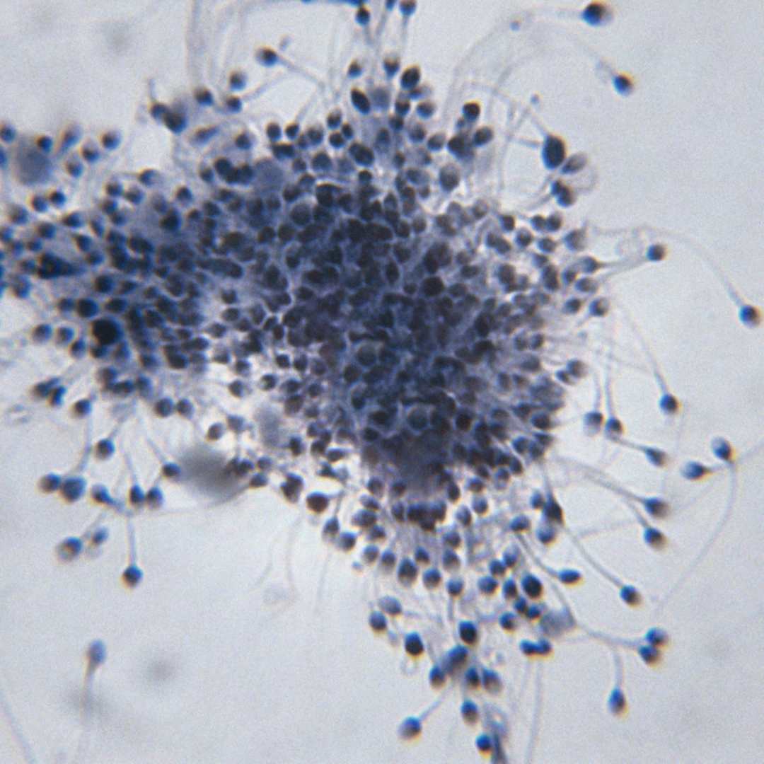 Spermatozoïdes au microscope - Meilleurs Microscopes
