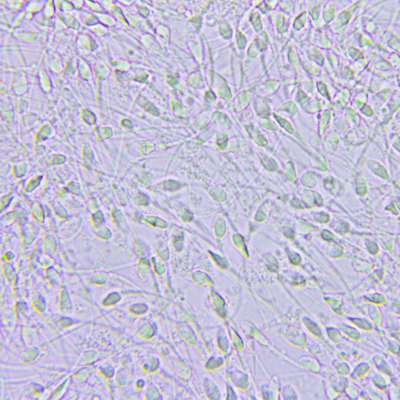 Spermatozoïdes au microscope - Meilleurs Microscopes