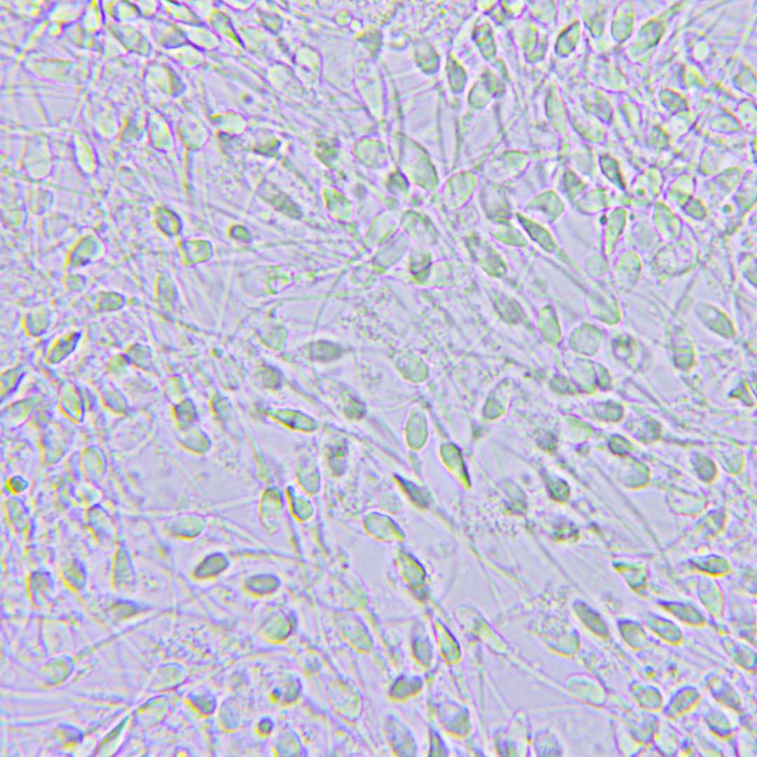 Spermatozoïdes au microscope - Meilleurs Microscopes